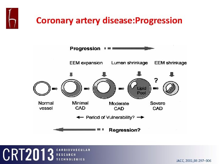 Prognostic Significance of Subtle Obstructive Lesions in Multislice
