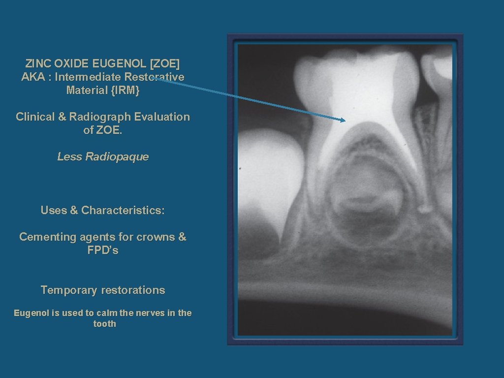 VIGNETTS of DENTAL RESTORATIONS by Opal Thomas RAD