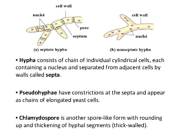FUNGAL INFECTIONS OF ORAL CAVITY Dr Gitanjali Khulbe