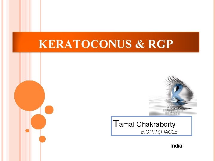 KERATOCONUS RGP Tamal Chakraborty B OPTM FIACLE India