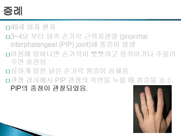 versus joint OA Radiographic OA prevalence PIP Age