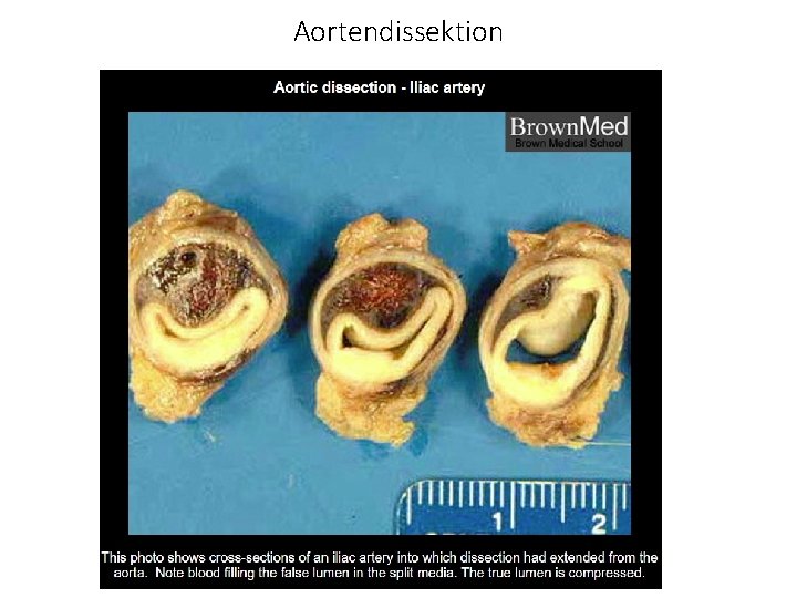 Histologie der Gefe Dr Szab Arnold szabo arnoldmed