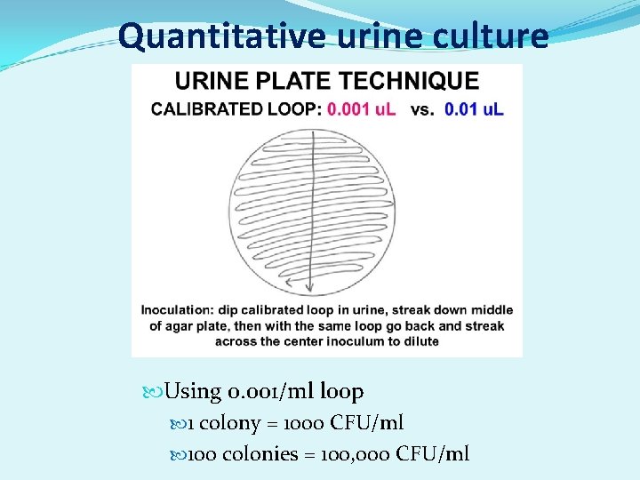 Practical of Urinary Tract Infection Department of Microbiology