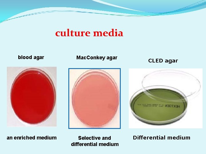 Practical of Urinary Tract Infection Department of Microbiology