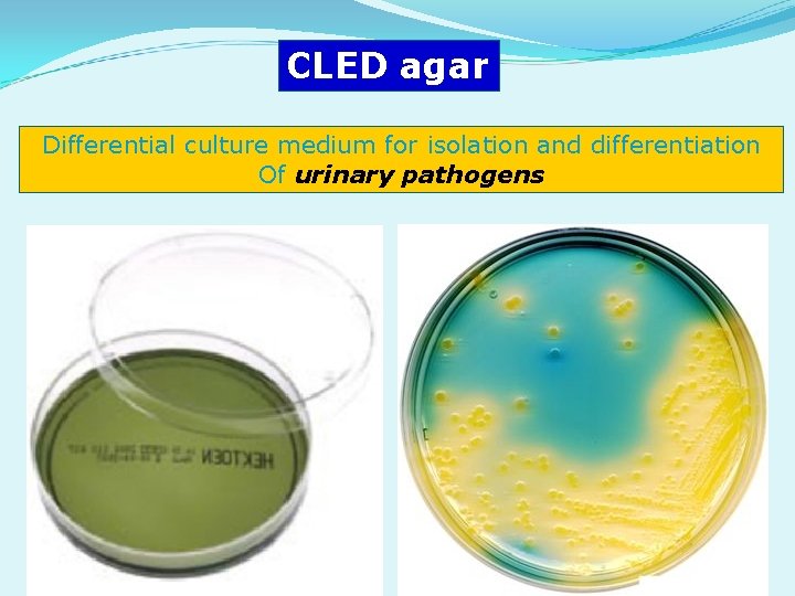 Practical of Urinary Tract Infection Department of Microbiology
