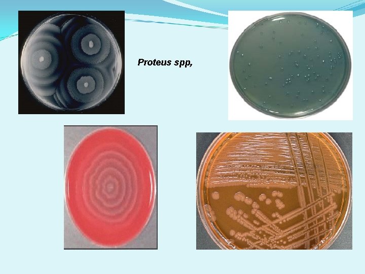 Practical of Urinary Tract Infection Department of Microbiology
