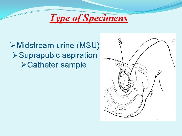 Practical of Urinary Tract Infection Department of Microbiology