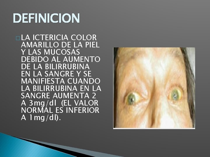 ICTERICIA DEFINICION LA ICTERICIA COLOR AMARILLO DE LA