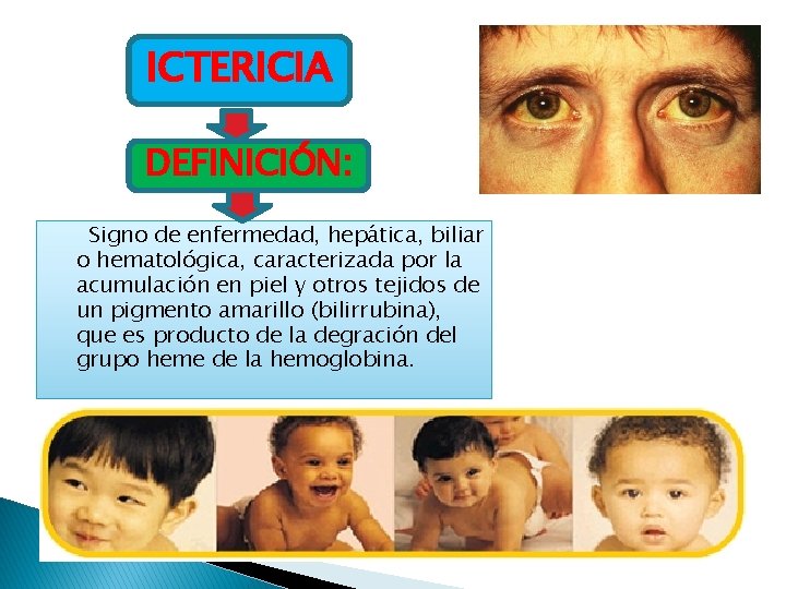ICTERICIA DEFINICION LA ICTERICIA COLOR AMARILLO DE LA