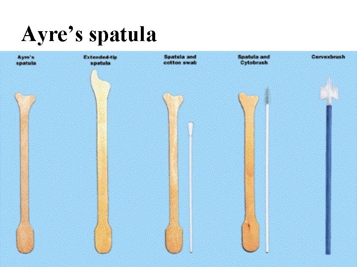 Cancer cervix preinvasive Dr Osama El ashkar Cervical