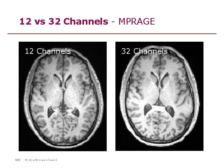 Beyond the Standard EPI New MRI Sequences available