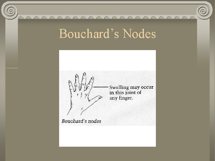 Musculoskeletal System Inflammatory Disorders Presentations Rheumatoid ...