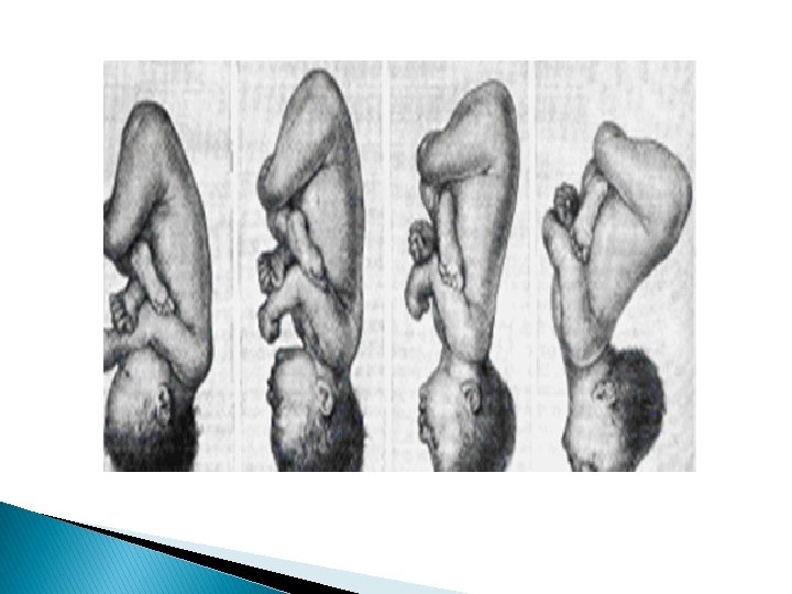 Abdominal Examination Abdominal Examination Definition It is a