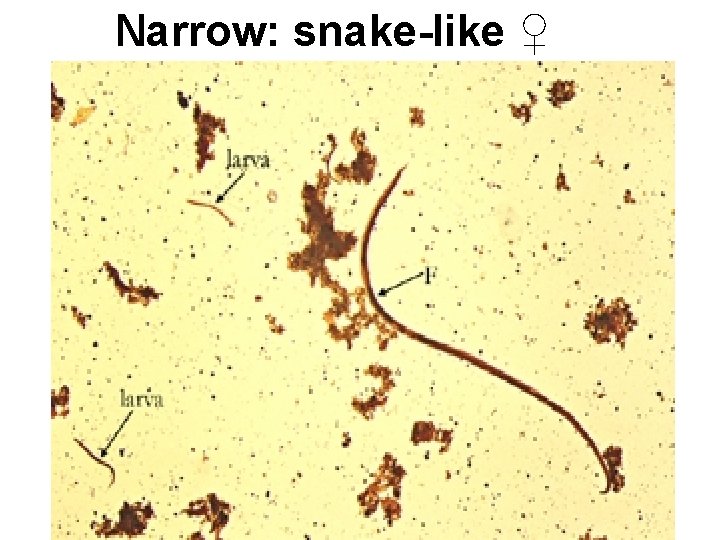 Strongyloides stercoralis Anguillula stercoralis Bavay 1876 Geographic ...