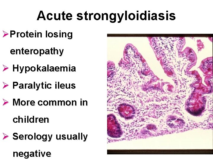 Strongyloides stercoralis Anguillula stercoralis Bavay 1876 Geographic ...