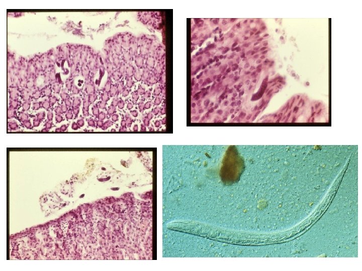 Strongyloides stercoralis Anguillula stercoralis Bavay 1876 Geographic ...