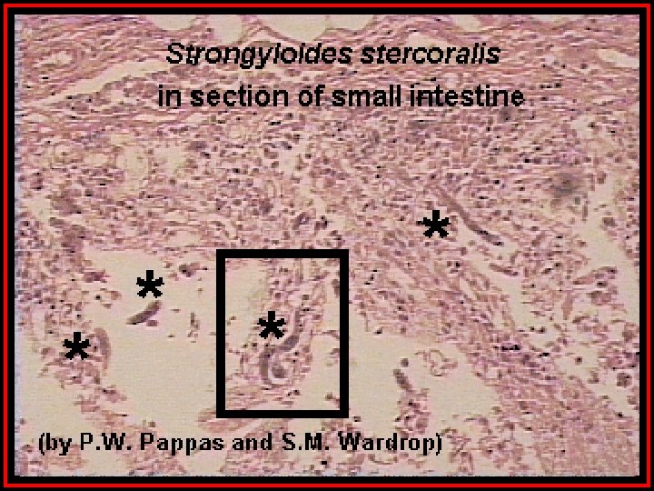 Strongyloides stercoralis Anguillula stercoralis Bavay 1876 Geographic ...