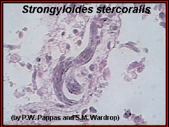 Strongyloides stercoralis Anguillula stercoralis Bavay 1876 Geographic ...