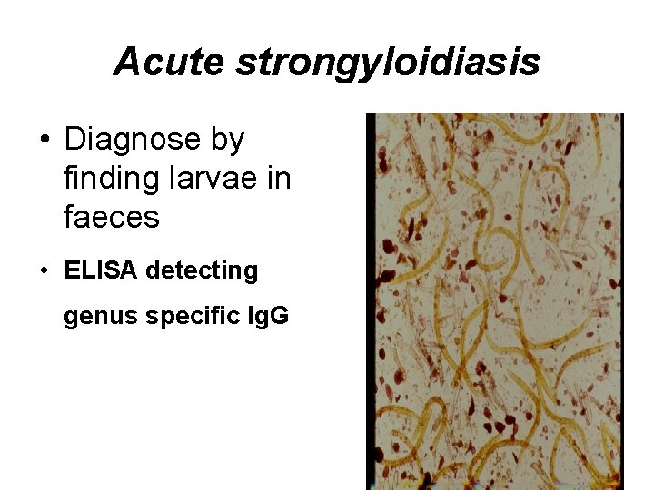 Strongyloides stercoralis Anguillula stercoralis Bavay 1876 Geographic ...