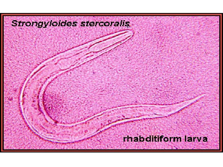 Strongyloides stercoralis Anguillula stercoralis Bavay 1876 Geographic ...