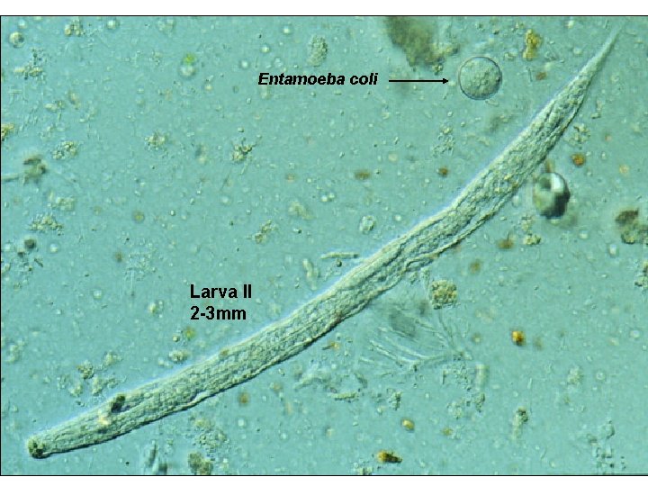 Strongyloides stercoralis Anguillula stercoralis Bavay 1876 Geographic ...