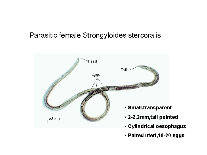 Strongyloides stercoralis Anguillula stercoralis Bavay 1876 Geographic ...