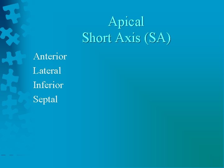 Adult Echocardiography Lecture 10 Coronary Anatomy holdorf Anterior