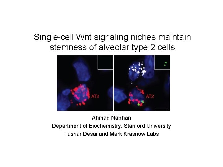 Singlecell Wnt signaling niches maintain stemness of alveolar