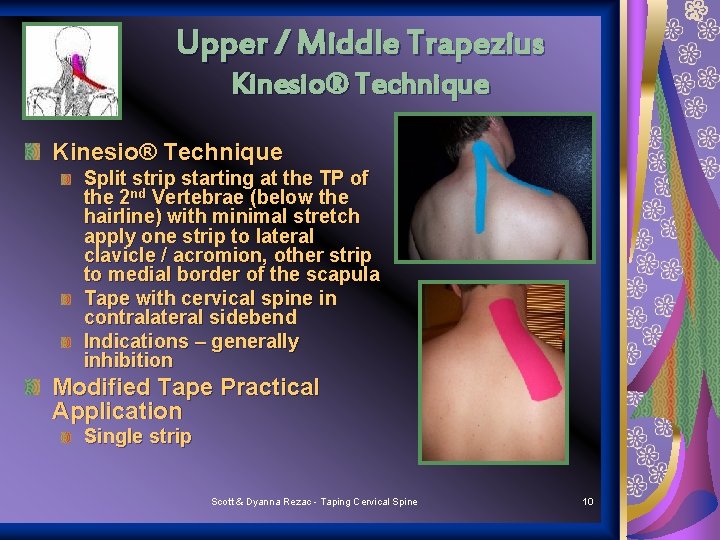 Therapeutic Taping for the Cervicothoracic Maxillofacial TMJ Dr
