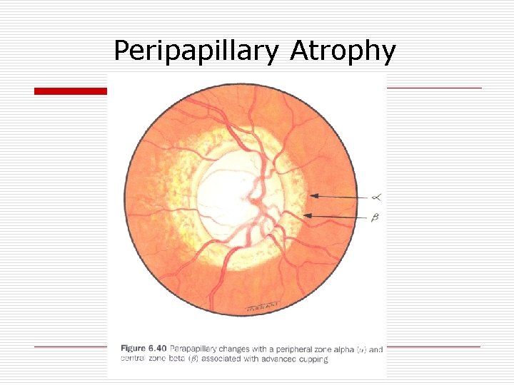 Understanding GLAUCOMA The Science Behind Current Testing and