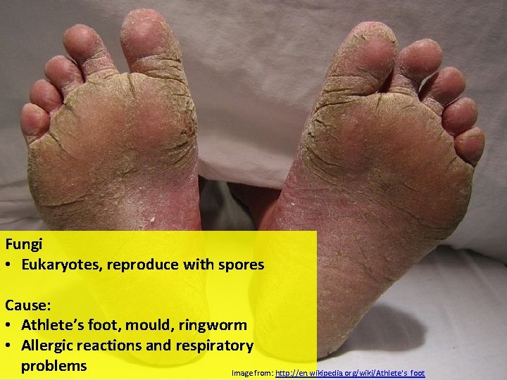 6 3 Defense against infectious disease Essential idea