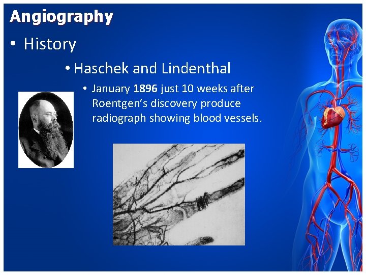 Angiography Cardiac Catheterization Uncle Daves Rads 2030 By