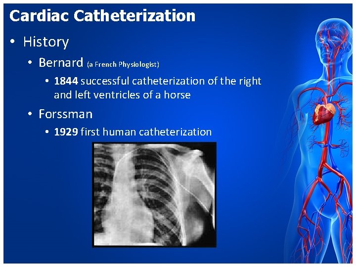 Angiography Cardiac Catheterization Uncle Daves Rads 2030 By