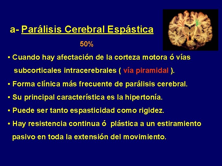 PARALISIS CEREBRAL INFANTIL Dr Mauricio De los Ros