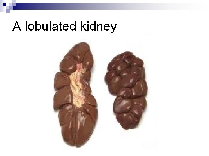 Histology of the urinary tract Dr Stuart Brown