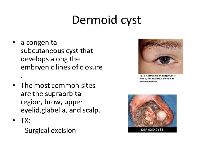 In the name of god Benign cutaneous and