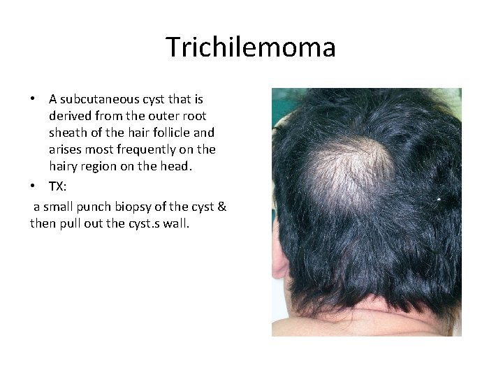 In the name of god Benign cutaneous and