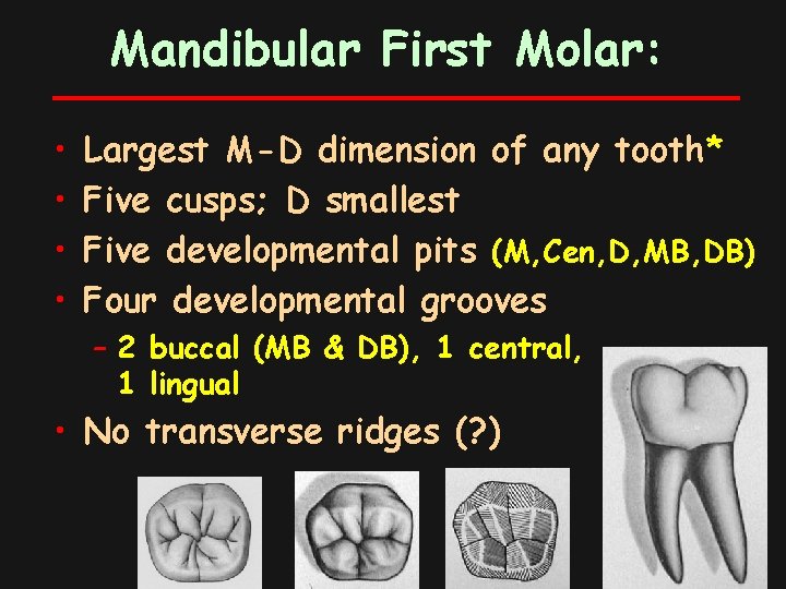 Molar Review Maxillary Molars Three roots L MB