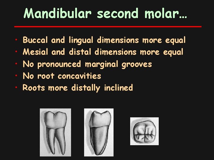 Molar Review Maxillary Molars Three roots L MB