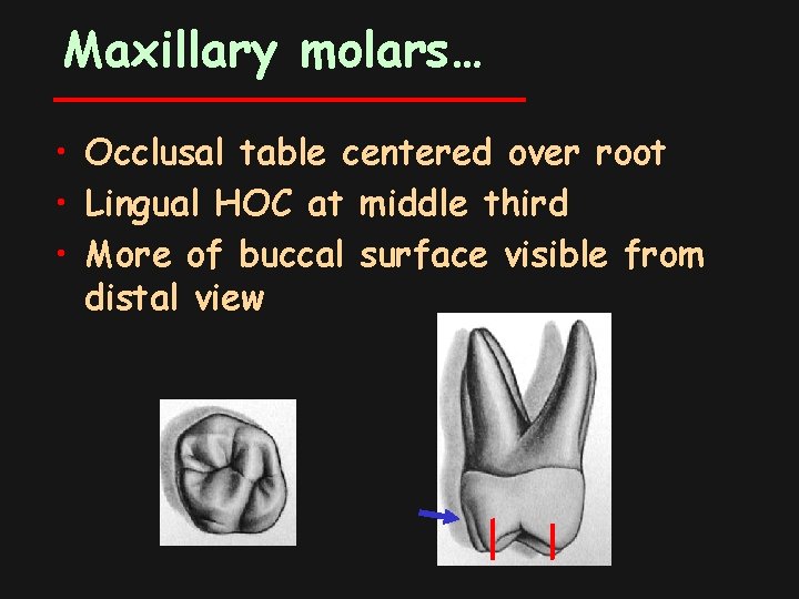 Molar Review Maxillary Molars Three roots L MB