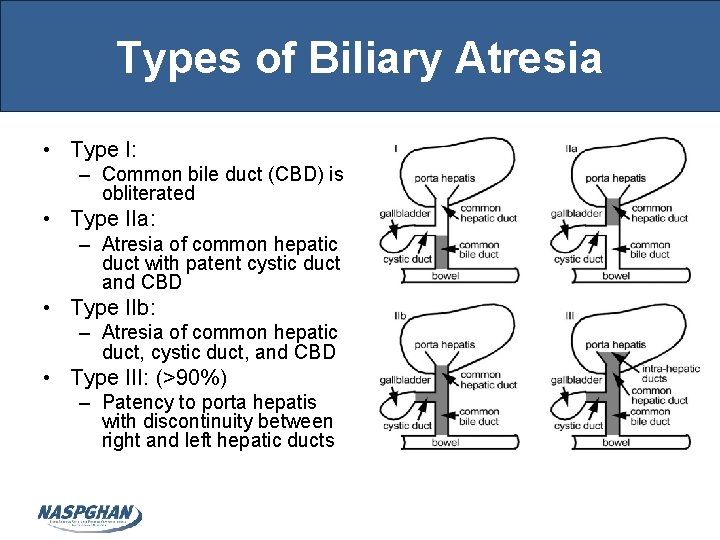 Biliary Atresia Kimberley Chien MD Mercedes Martinez MD