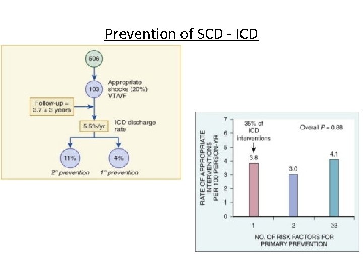 HYPERTROPHIC CARDIOMYOPATHY DIAGNOSIS AND MANAGEMENT DR TAHSIN N
