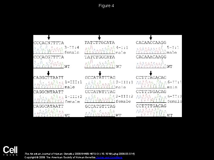 IFAP Syndrome Is Caused by Deficiency in MBTPS