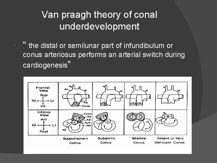 DOUBLE OUTLET RIGHT VENTRICLE Dr Kshitij Mavade Introduction