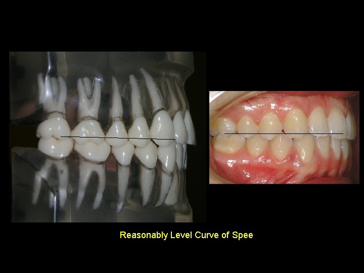 Orthodontics Current Concepts in Diagnosis and Treatment Planning