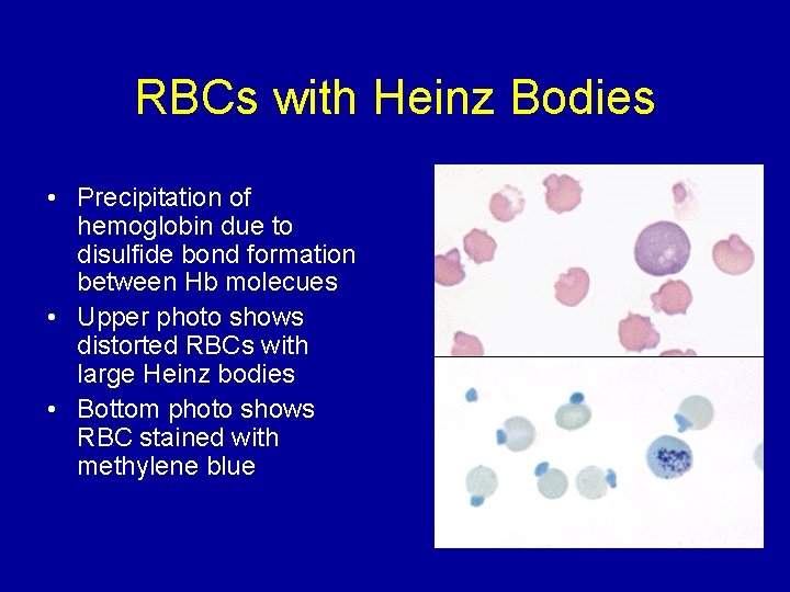 Is Methylene Blue Safe In Patients With Methemoglobinemia