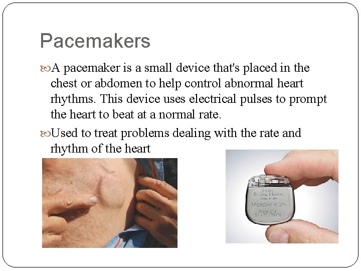 Blood pressure Jazlynn Tan 11 What is high