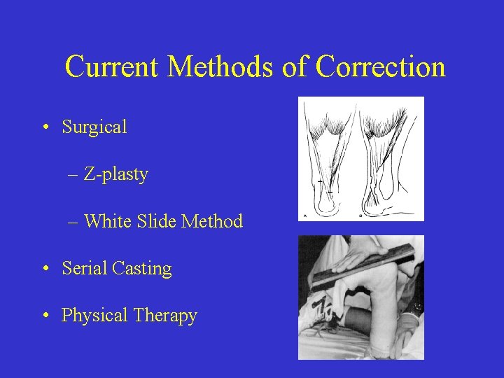 Heel Cord Lengthening Assist Device Presenters Sarah Holloway