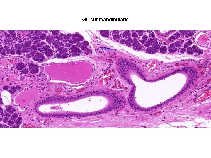 Lymphstmme Lymphwege Dr Altdorfer Gl submandibularis Lymphe klares