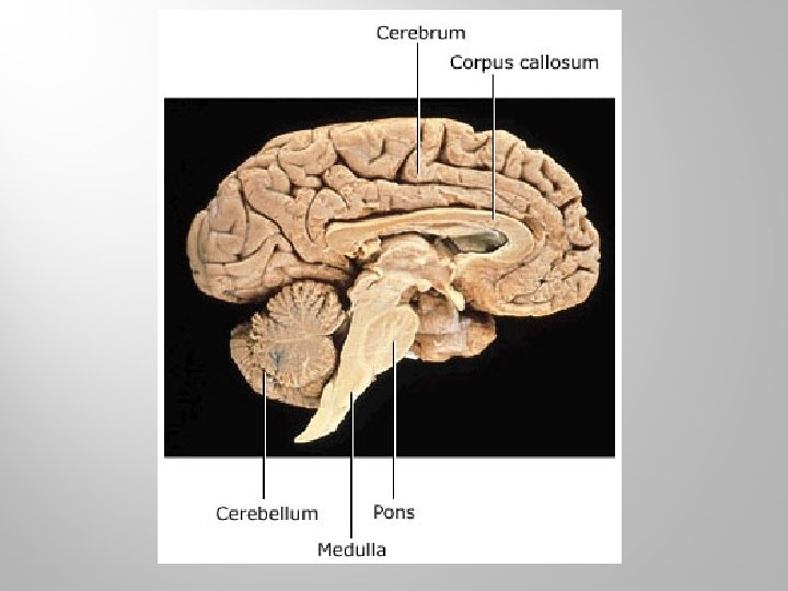CNS NOTES Parts of the Brain CNS BRAIN